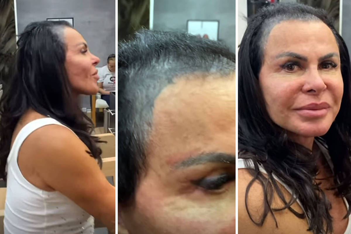 Gretchen mostra calvície nas redes sociais - 02/10/2024 - Celebridades - F5